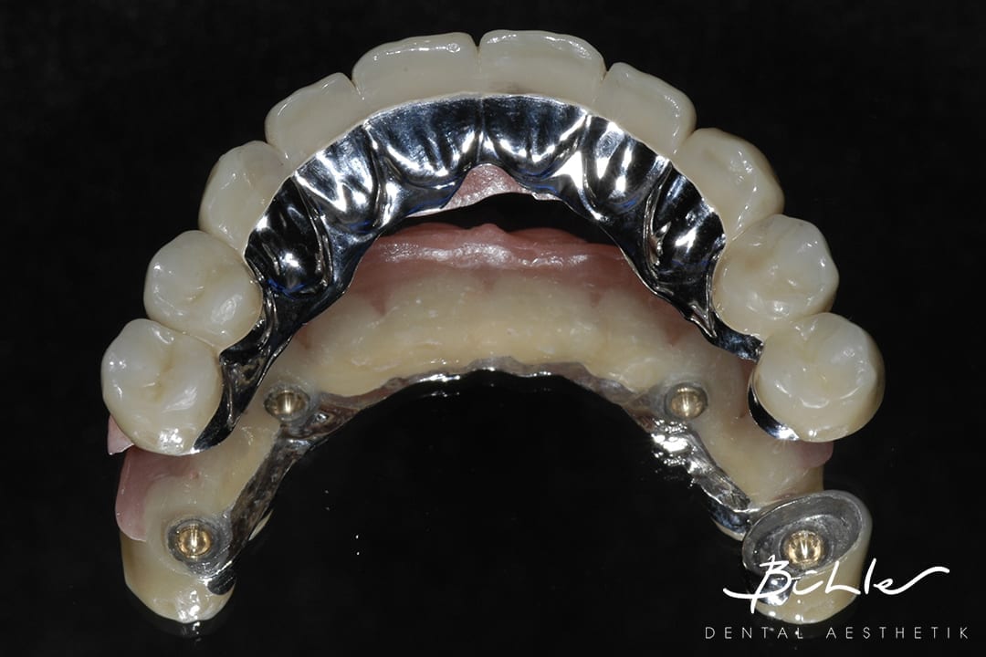 Bühler Dental Aesthetik, Zürich