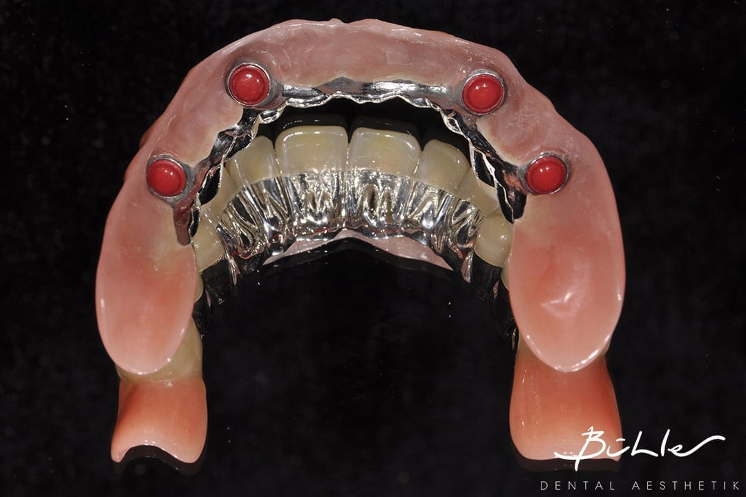 Bühler Dental Aesthetik, Zürich